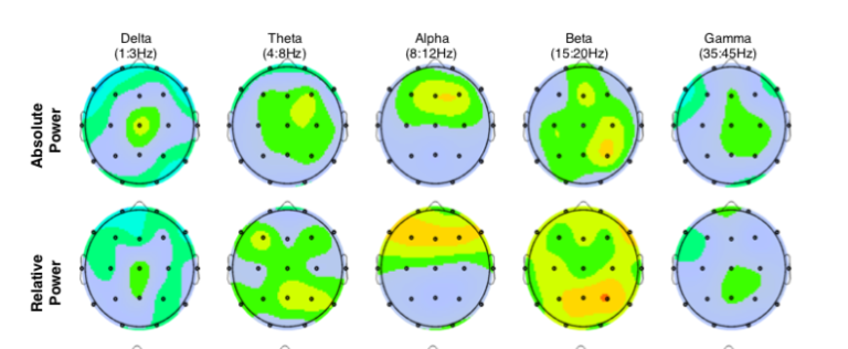 Discover the Benefits of QEEG Brain Mapping